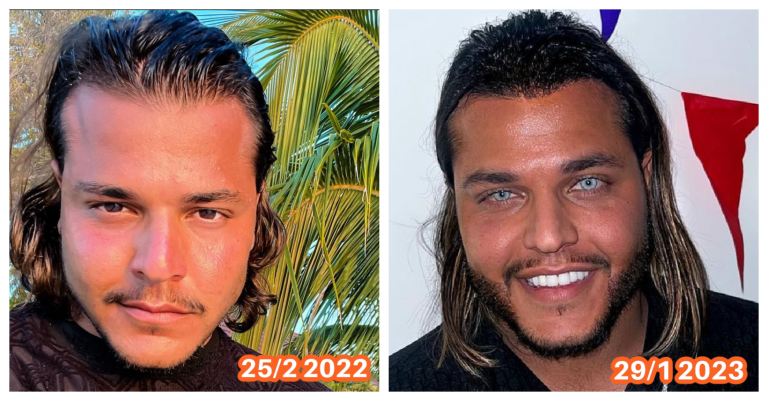 Haidar Jumas nya ögonfärg - Bloggbevakning