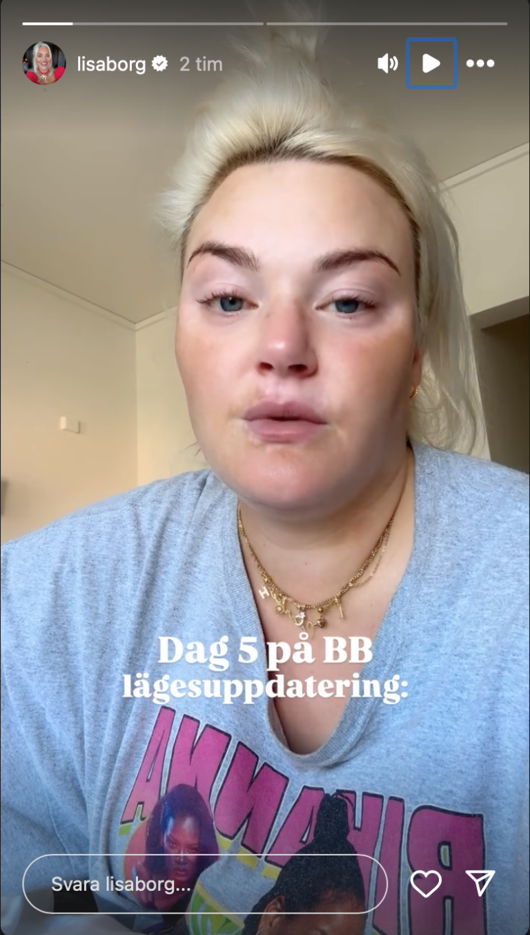 Lisa Borg blir kvar på sjukhuset - Bloggbevakning