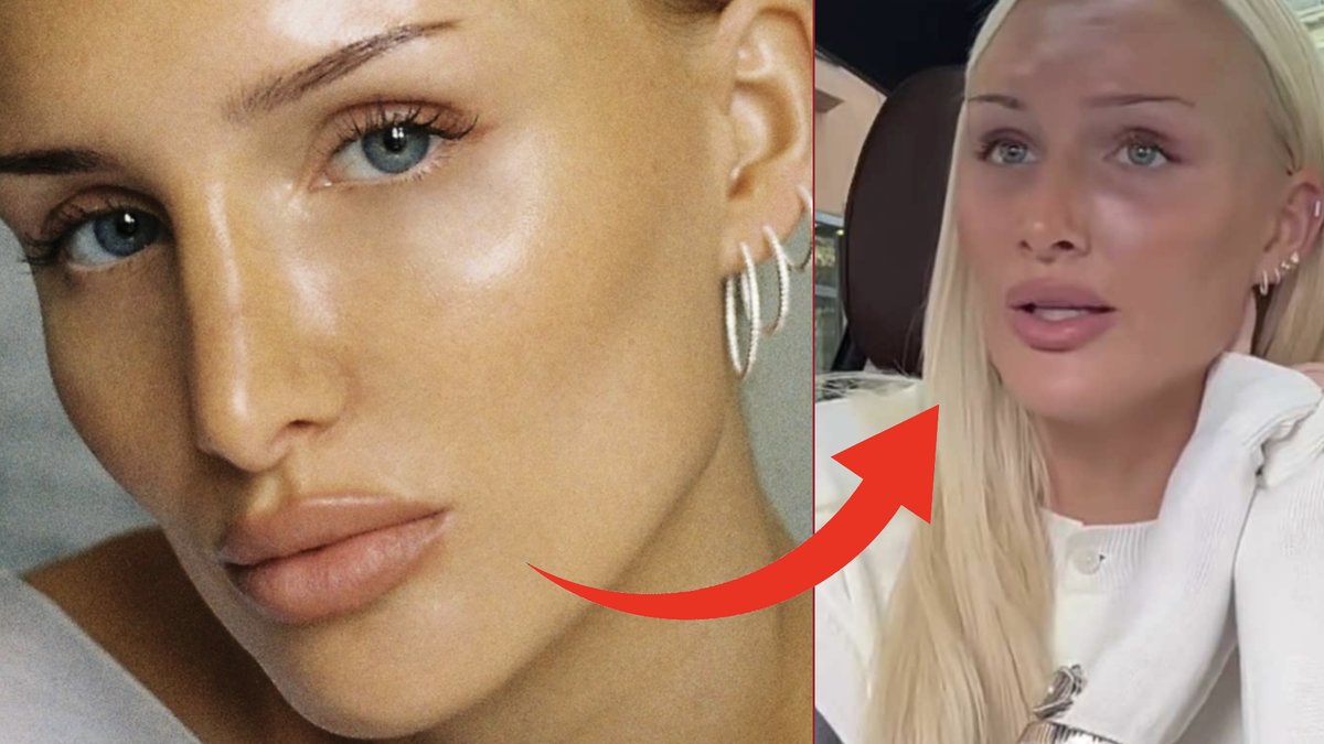 Nu hintar Lovisa Worge om vad som egentligen har hänt henne